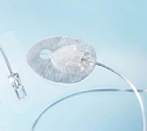 Infuusset, Subcutane Infusie, Neria Soft - Vivas Medica B.V.